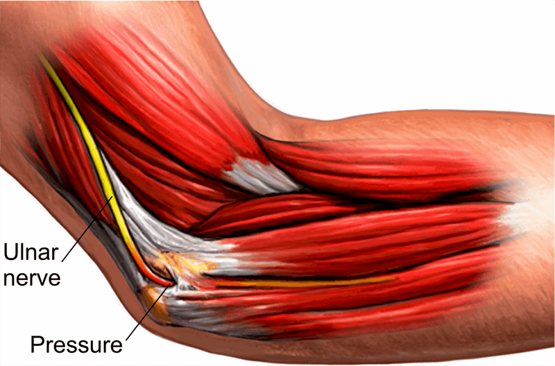 Nerve decompression – for pain relief and recovery - Riga 1st Hospital